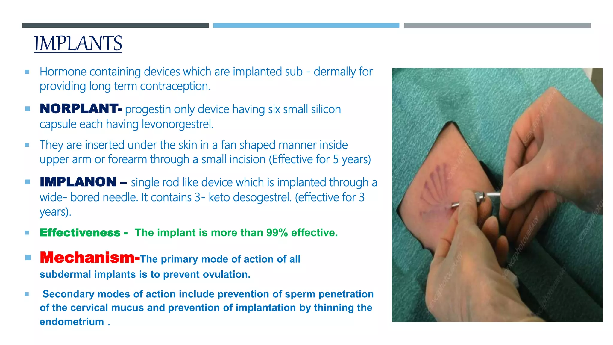 Contraceptive types and its mechanism | PPTX