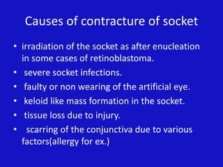 Contracted eye socket reconstruction | PPTX