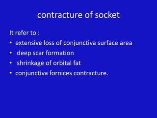 Contracted eye socket reconstruction | PPTX