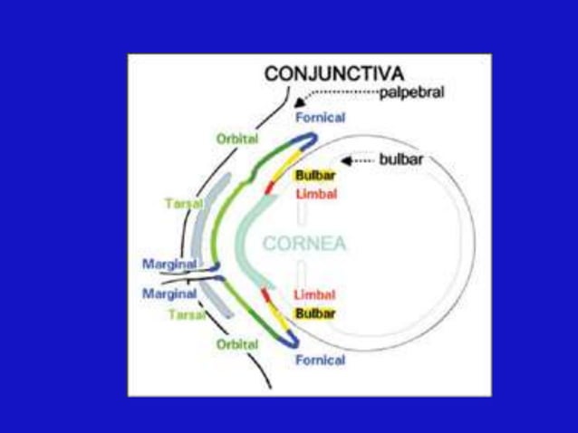 Contracted eye socket reconstruction
