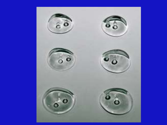 Contracted eye socket reconstruction