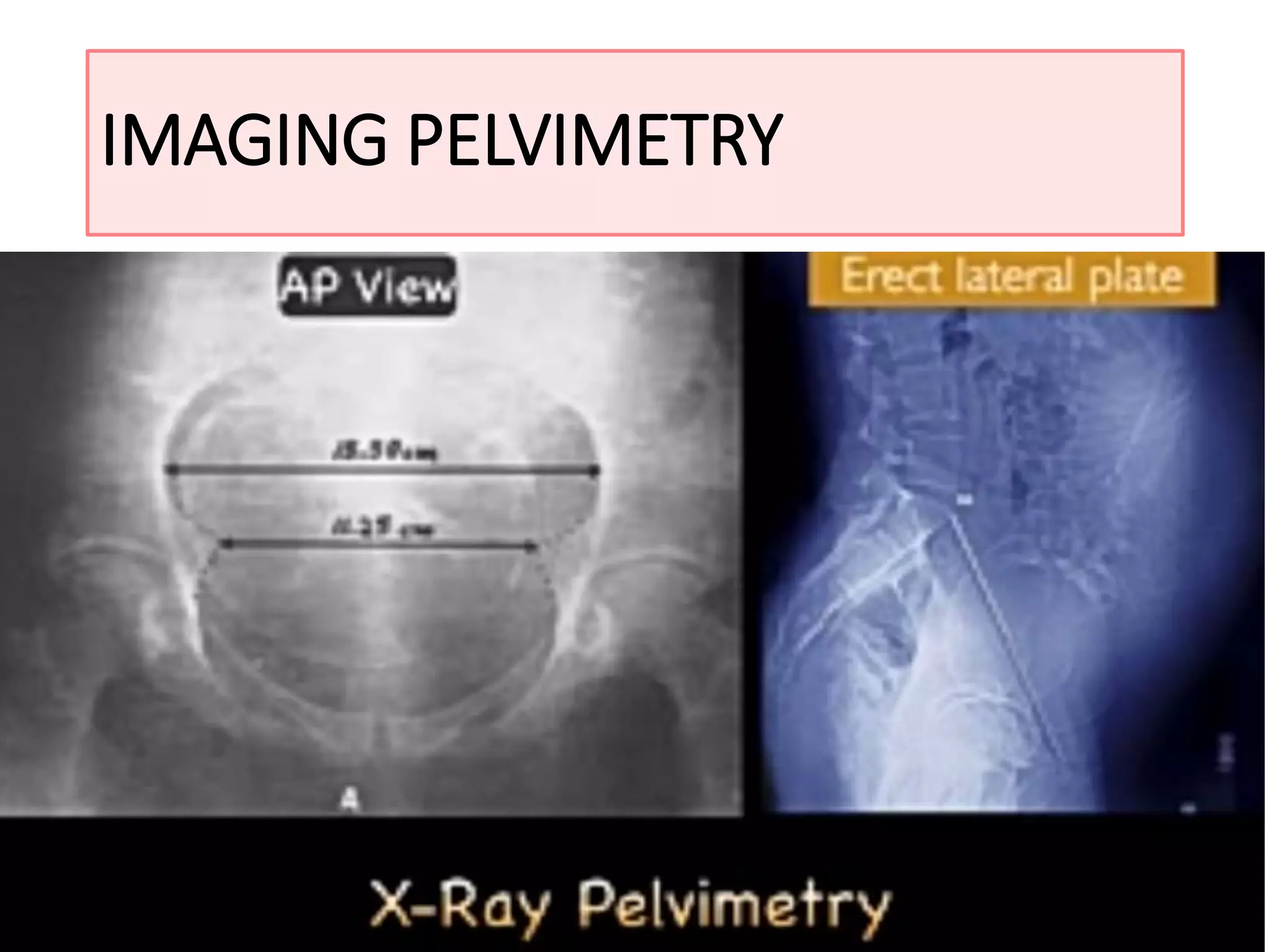 Contracted labor | PPTX
