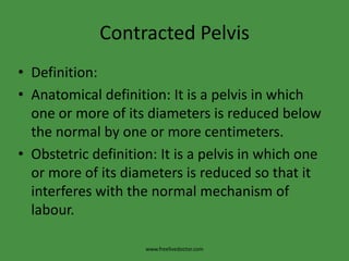 Contracted pelvis | PPTX