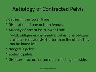 Contracted pelvis | PPTX