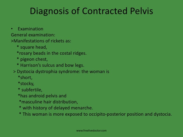 Contracted Pelvis