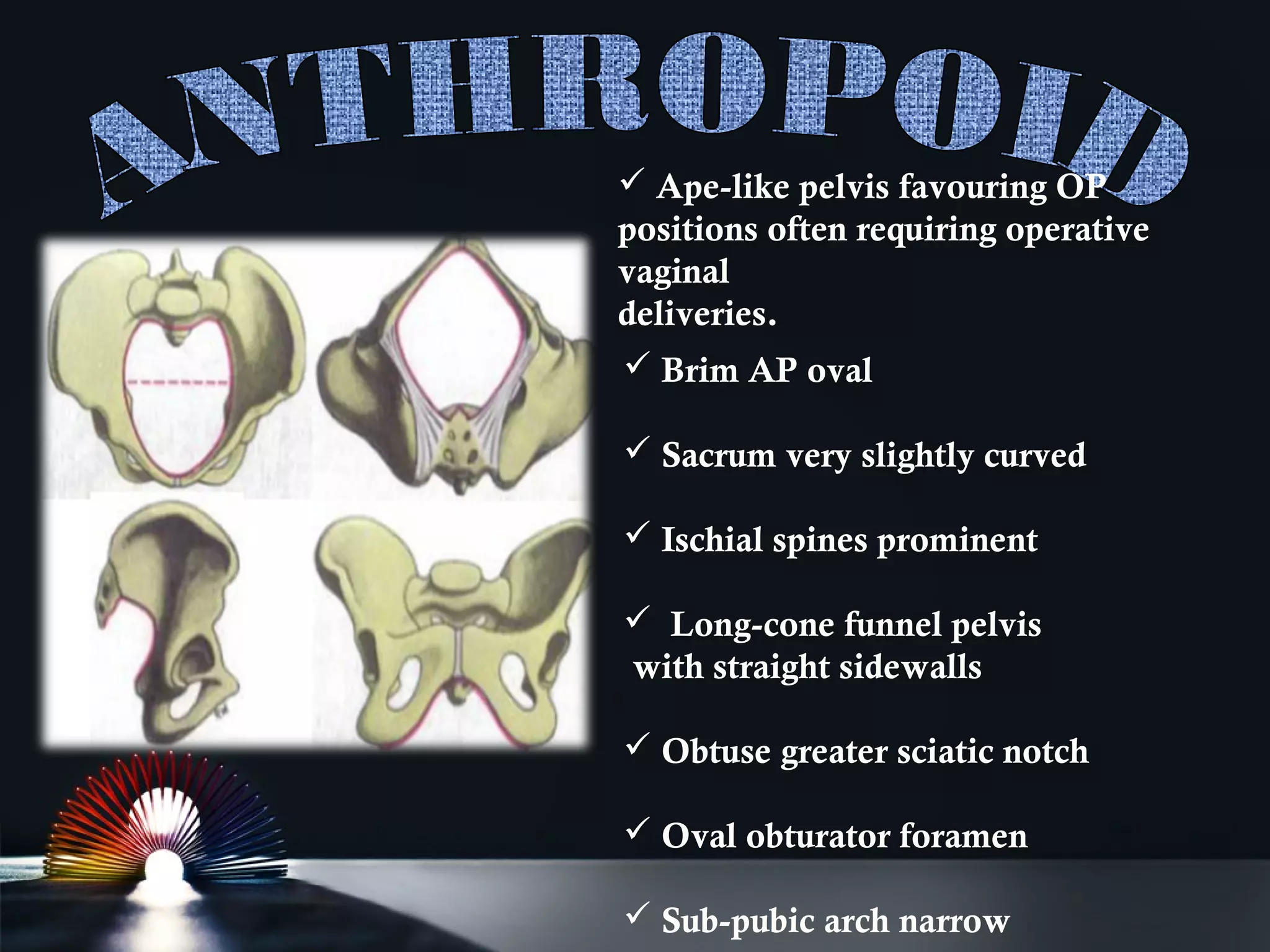 Contracted pelvis | PPT