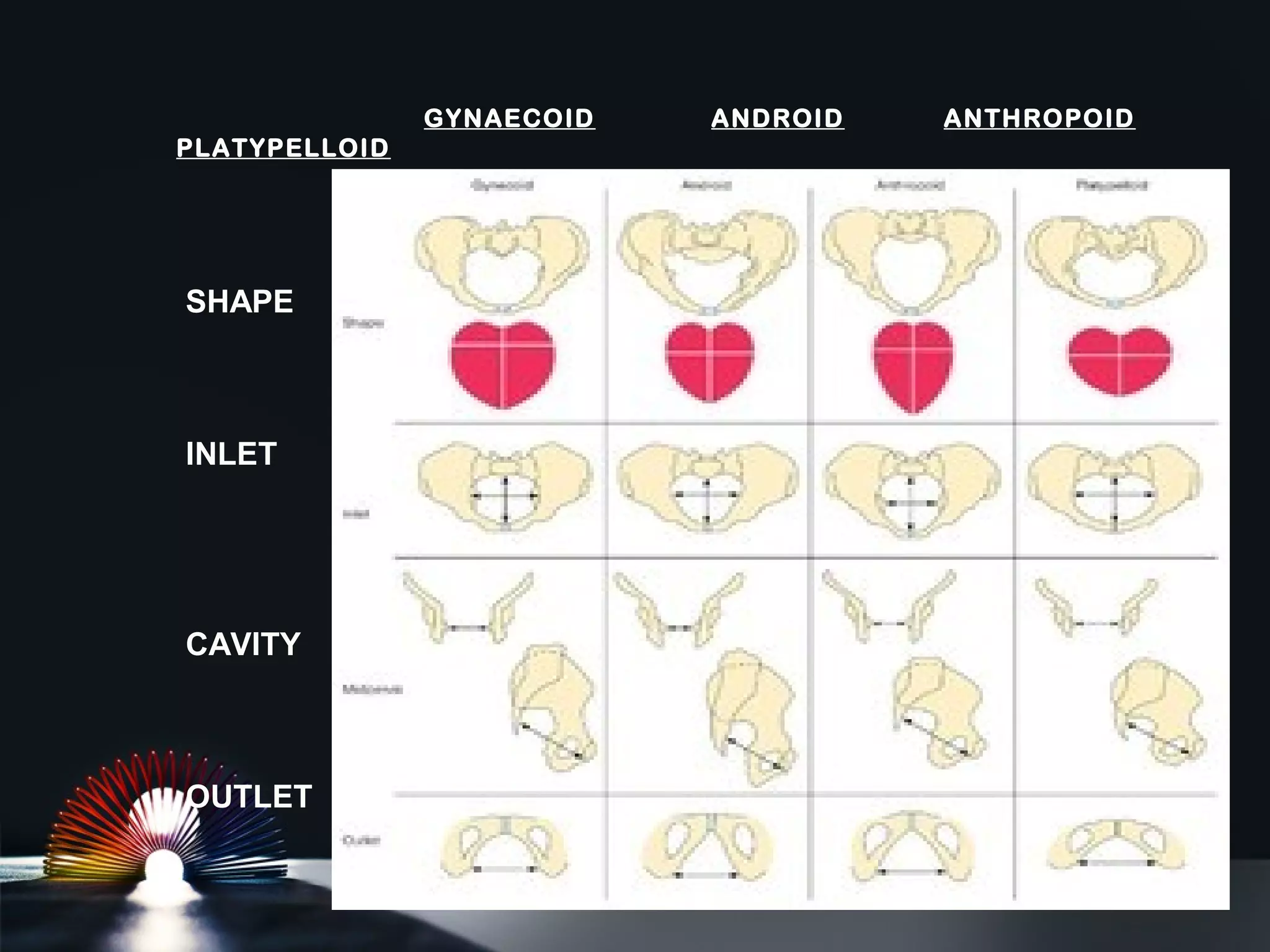 Contracted pelvis | PPT
