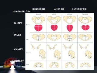 Contracted pelvis | PPT
