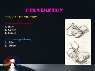 Contracted pelvis | PPT