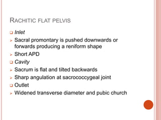 Rachitic Pelvis