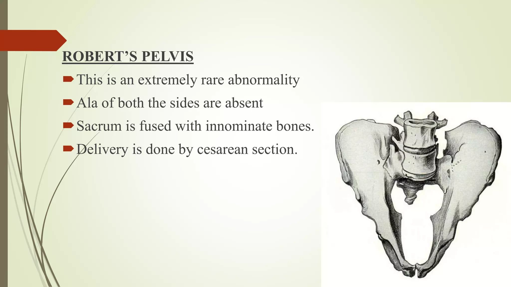 Contracted pelvis | PPTX