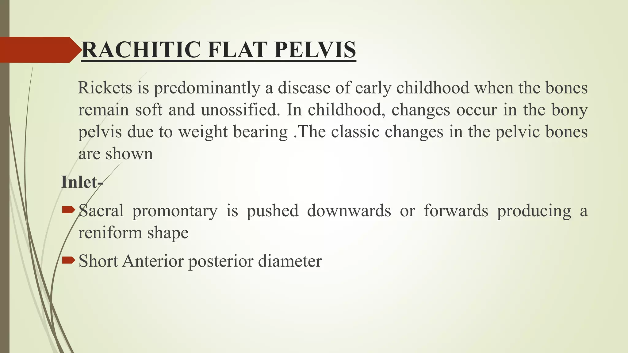 Contracted pelvis | PPTX