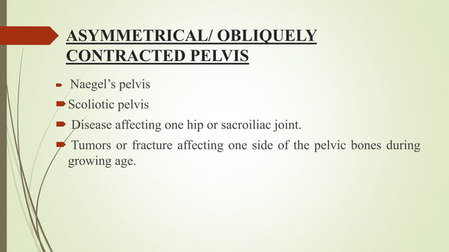 Contracted pelvis | PPTX