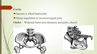 Contracted pelvis | PPTX