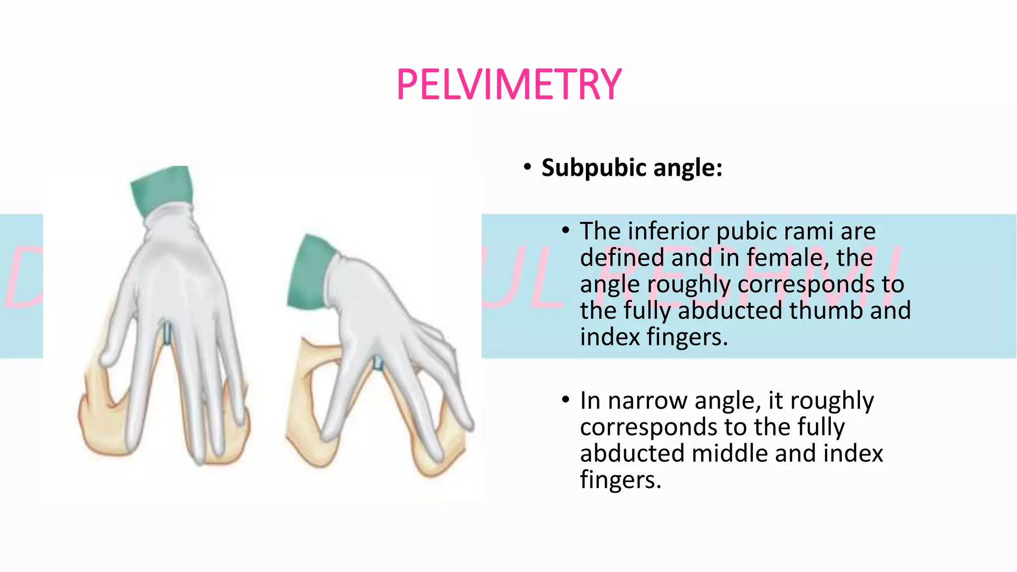 Contracted pelvis - CEPHALOPELVIC DISPROPORTION | PPTX