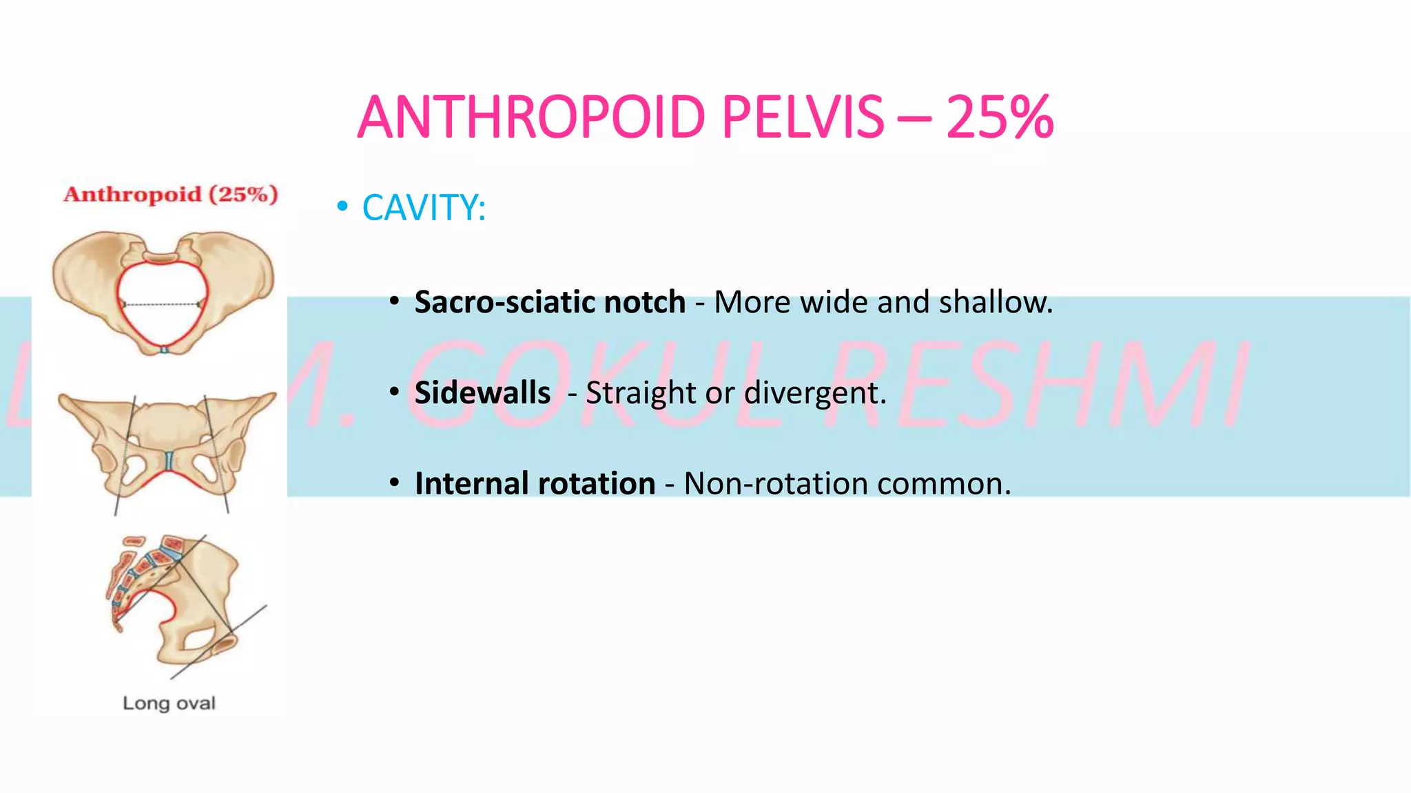 Contracted pelvis - CEPHALOPELVIC DISPROPORTION | PPTX