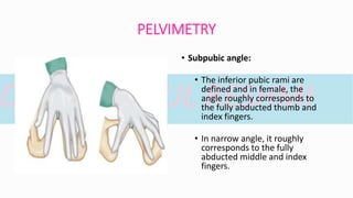 Contracted pelvis - CEPHALOPELVIC DISPROPORTION | PPTX
