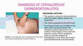 Cephalopelvic Disproportion Diagnosis