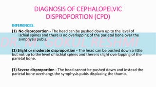 Cephalopelvic Disproportion Ppt