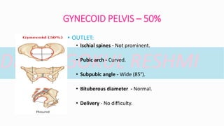 Contracted pelvis - CEPHALOPELVIC DISPROPORTION | PPT