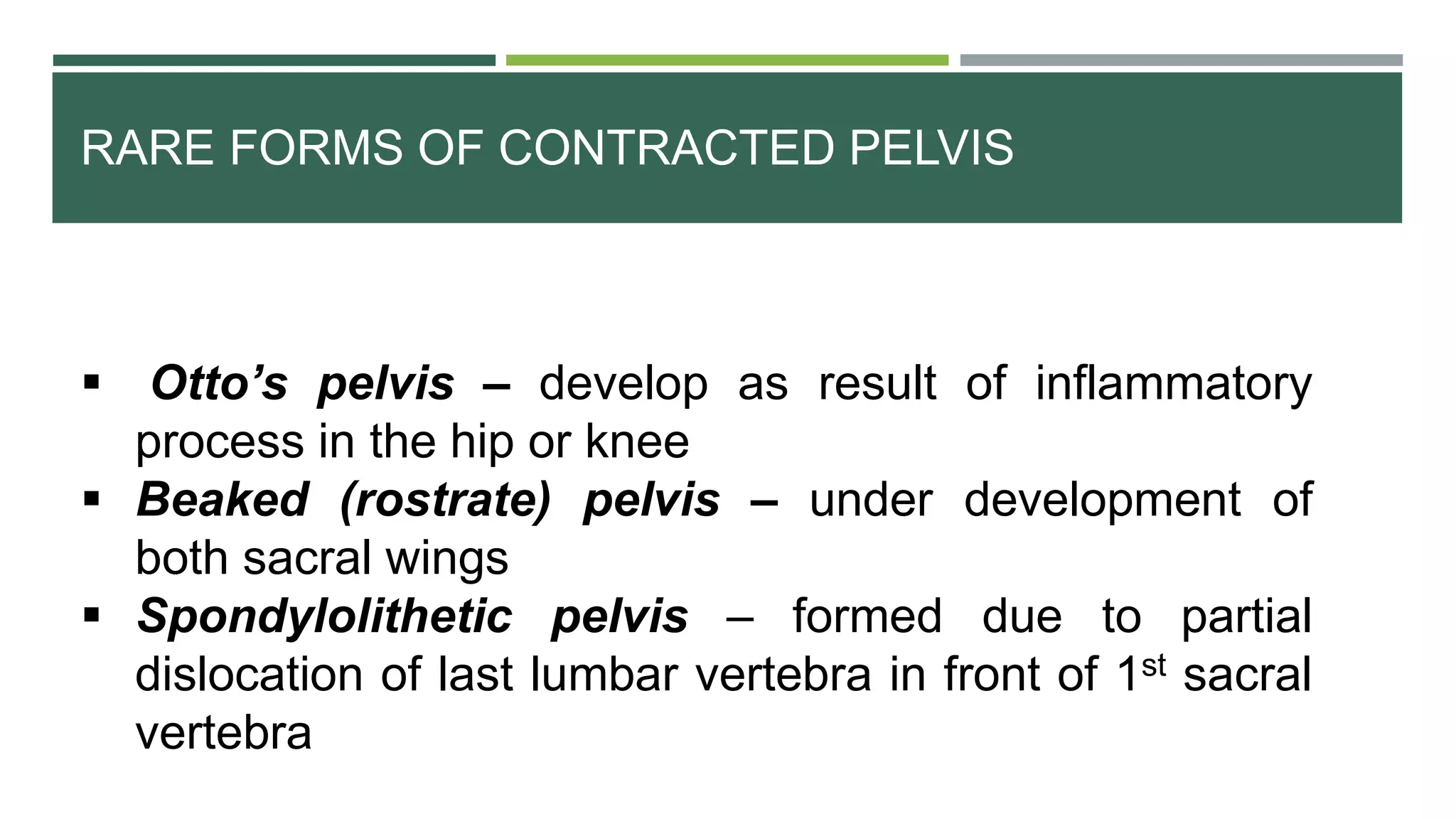 Contracted pelvis | PPTX