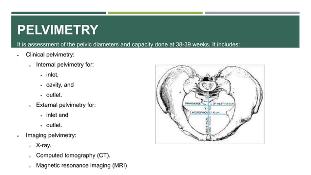 Contracted pelvis | PPTX | Pregnancy | Reproductive Health