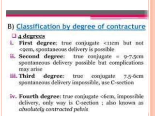 Obg contracted pelvis and other pelvic deformations | PPT