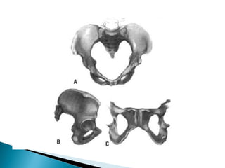 Types of pelvis and contracted pelvis ppt | PPT