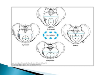 Types of pelvis and contracted pelvis ppt | PPT