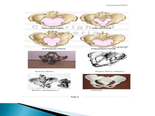 Types of pelvis and contracted pelvis ppt | PPT