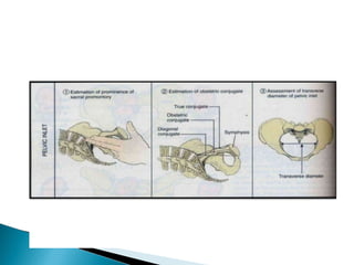 Types of pelvis and contracted pelvis ppt | PPT
