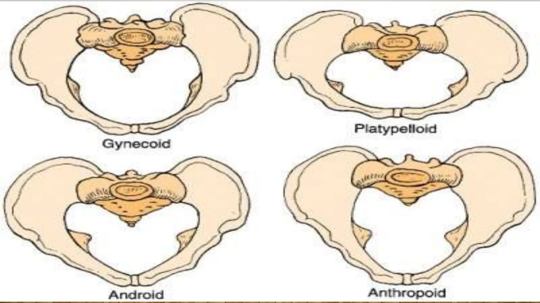 contracted pelvis and cephalopelvic disproportion.pptx