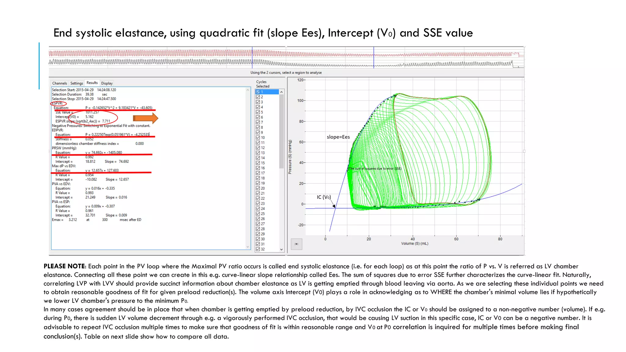 Cardiac Contractility Using Qa Interval Ppt