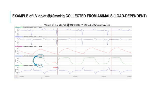 Cardiac Contractility Using Qa Interval Ppt