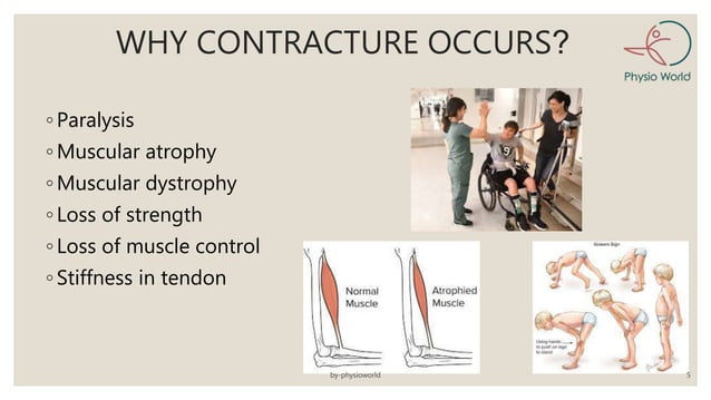 Contracture | PPTX | Death, Injury, or Military Conflict | Sensitive Topics