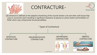 Contracture | PPT