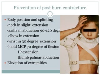 Contracture managment.pptx
