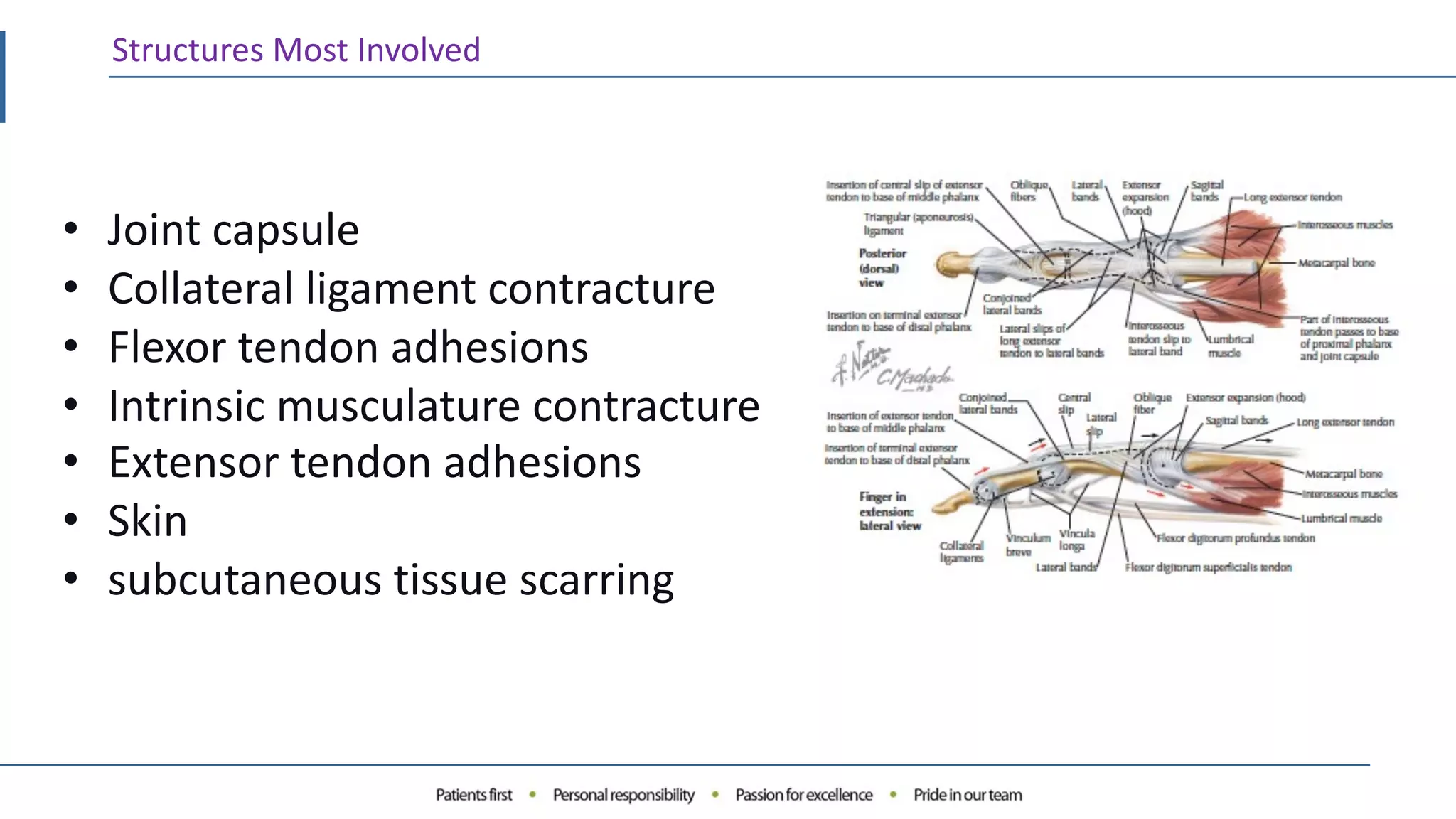 Posttraumatic Metacarpophalangeal and Proximal Interphalangeal Joint ...