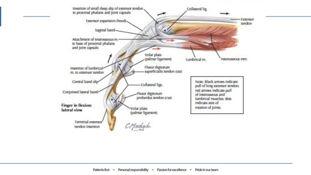 Posttraumatic Metacarpophalangeal and Proximal Interphalangeal Joint ...