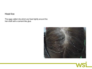 Contraindications | PPT