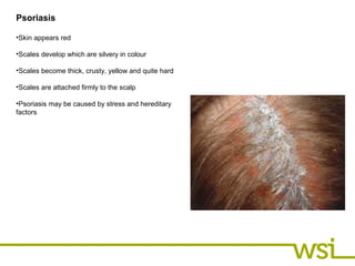 Contraindications | PPT