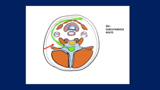 Contralateral c7 CC7 transfer | PPTX