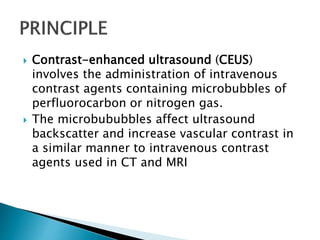 Contrast enhanced ultrasound | PPTX