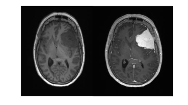 Contrast agent use in radiology newer technique | PPT