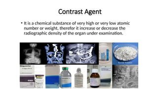 Contrast agent use in radiology newer technique | PPTX