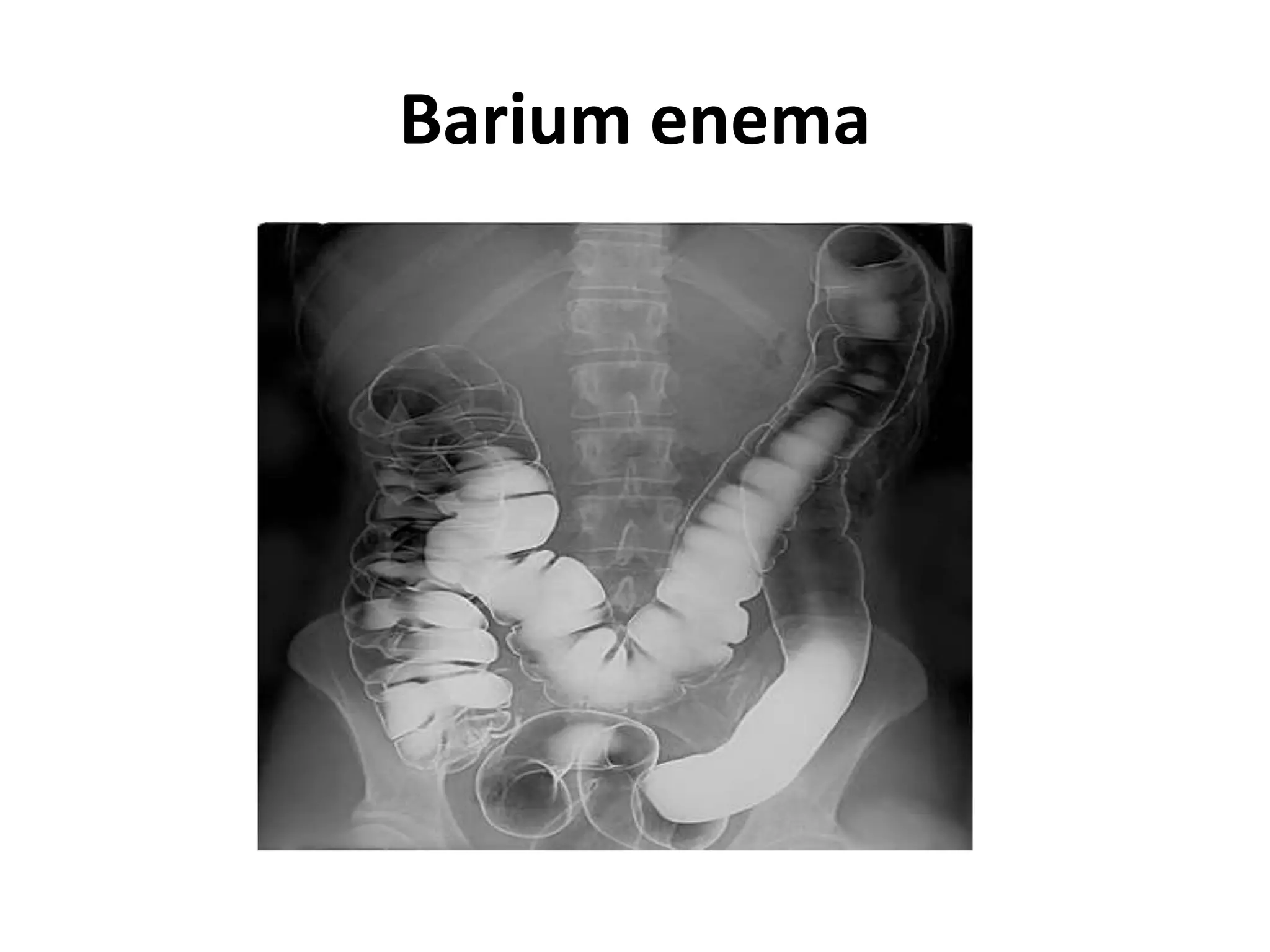 Contrast agents ppt | PPTX