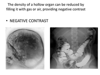 Contrast agents ppt | PPTX