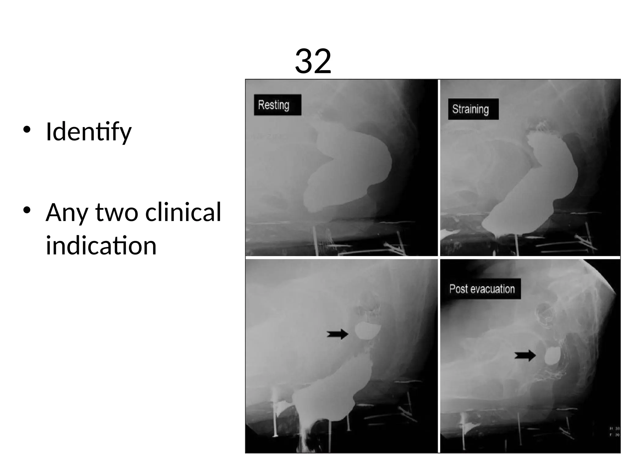 Contrast and special radiographic procedures New (1).ppt
