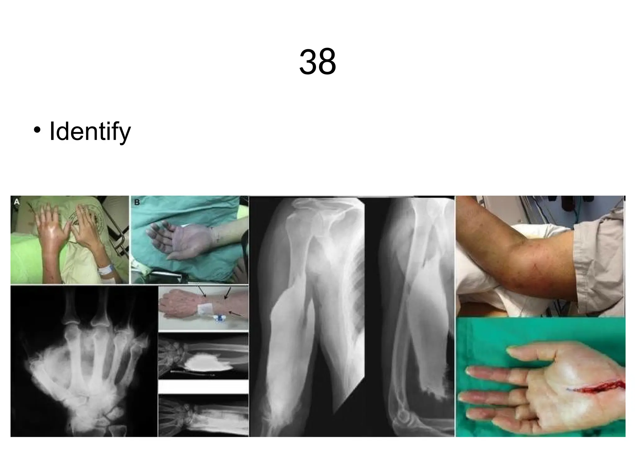 Contrast and special radiographic procedures New (1).ppt | Medical ...