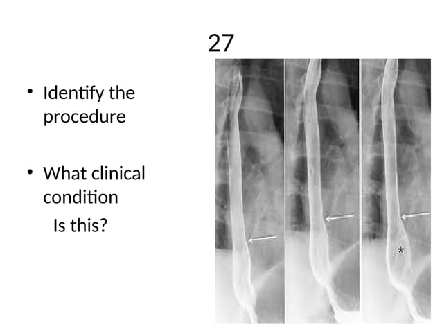 Contrast and special radiographic procedures New (1).ppt | Medical ...